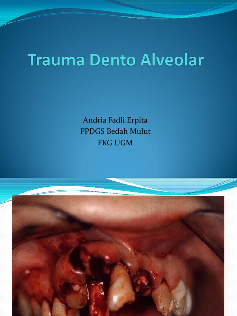 Jelenko Arch Bar dalam Trauma Dentoalveolar | PDF