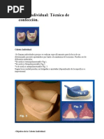 Festoneado en Odontología y Prótesis Total | PDF | Dentadura postiza ...