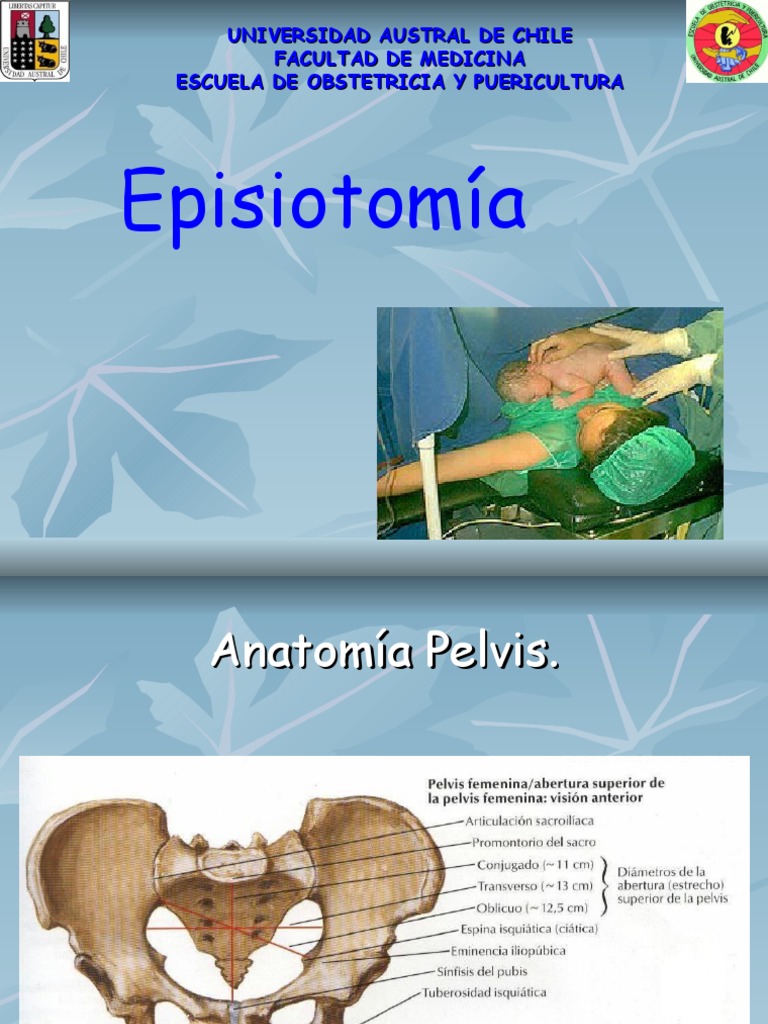 Episiotomía | PDF | Vagina | Parto