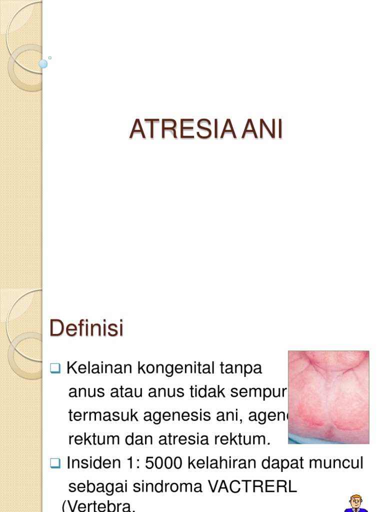 Atresia Ani | PDF