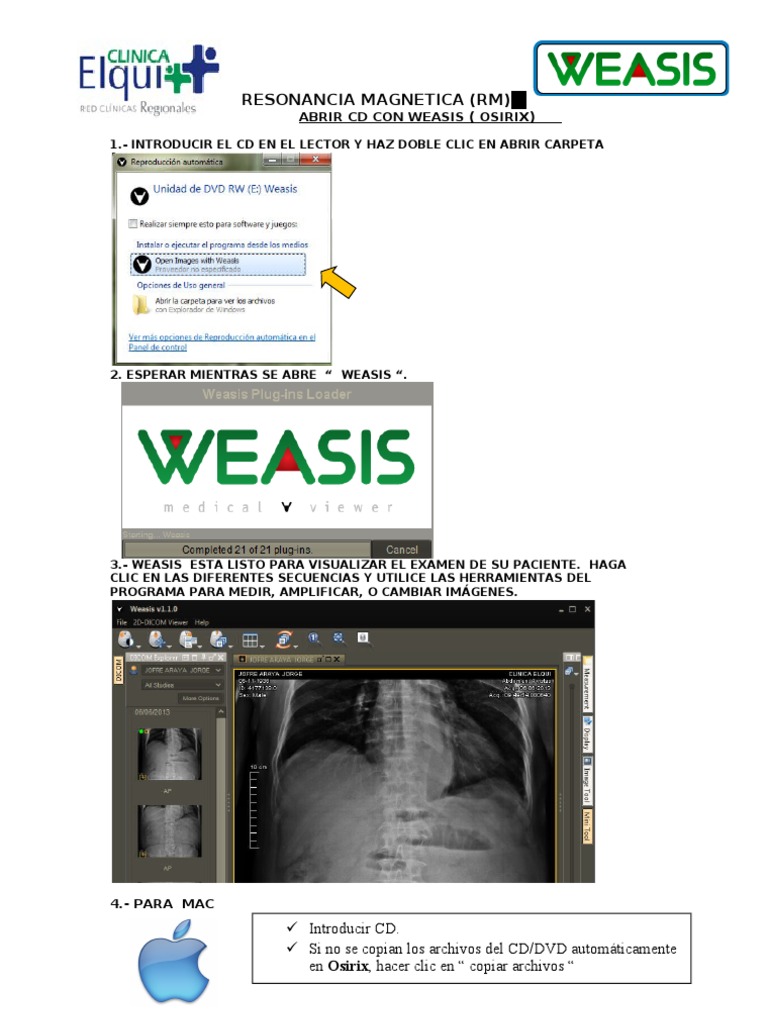 Efilm Instructivo CD Weasis | PDF