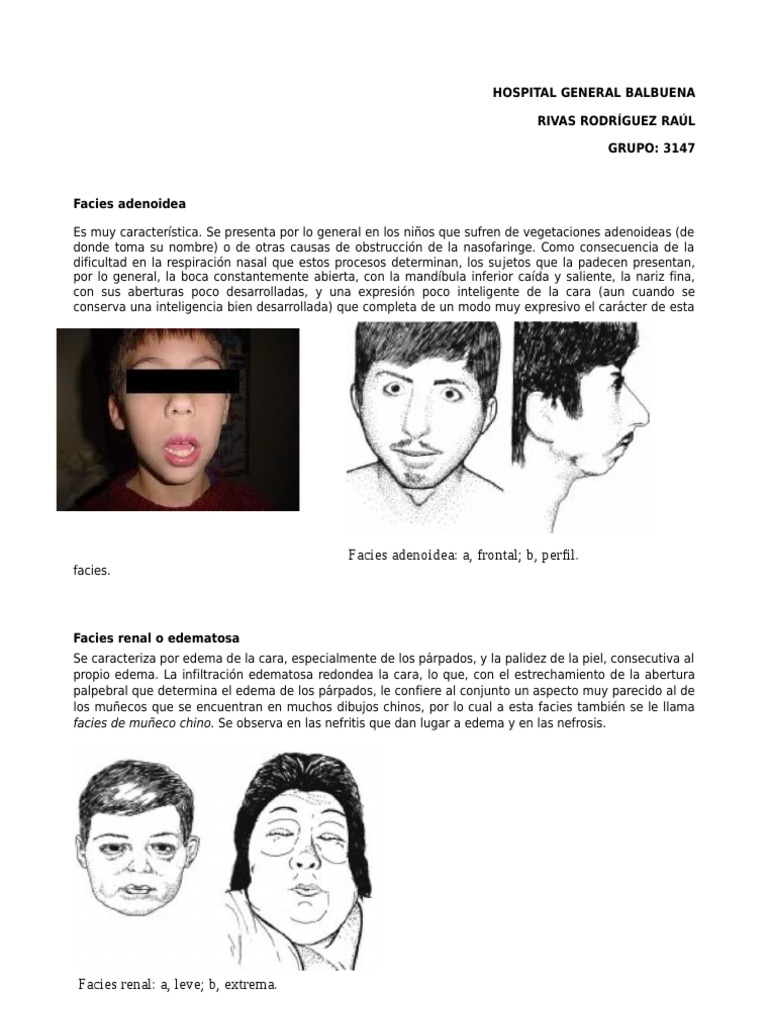 Facies | PDF | Cráneo | Anatomía