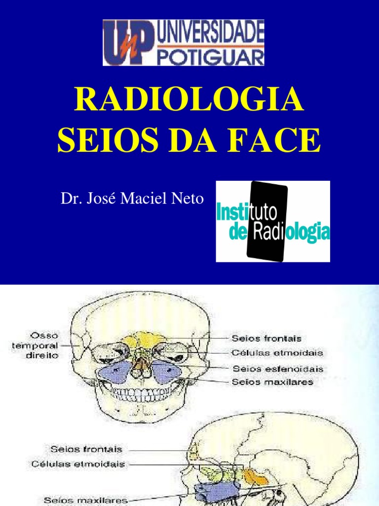 Radiologia dos Seios da Face | PDF | Ciências e Matemática