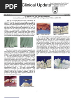 Post-Dam in Complete Dentures | PDF | Dentures | Nature
