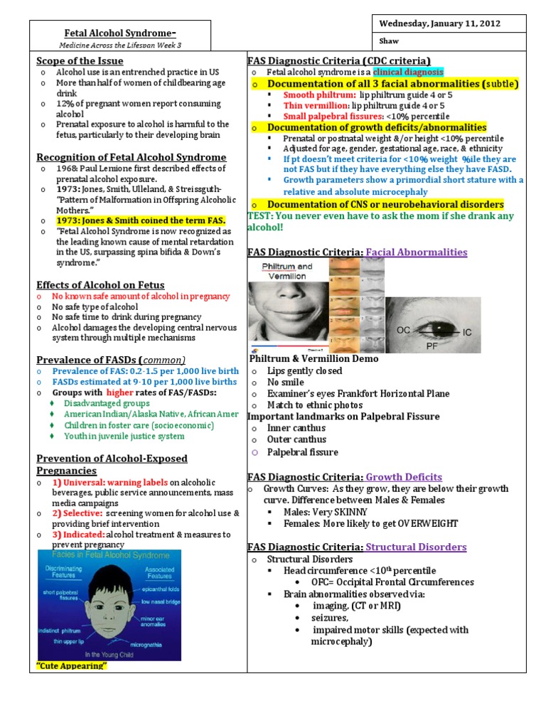 Fetal Alcohol Syndrome: Clinical Diagnosis Smooth Philtrum: Thin ...