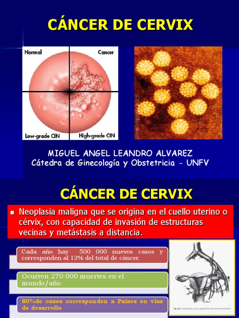 CACU | PDF | Cáncer de cuello uterino | Cáncer