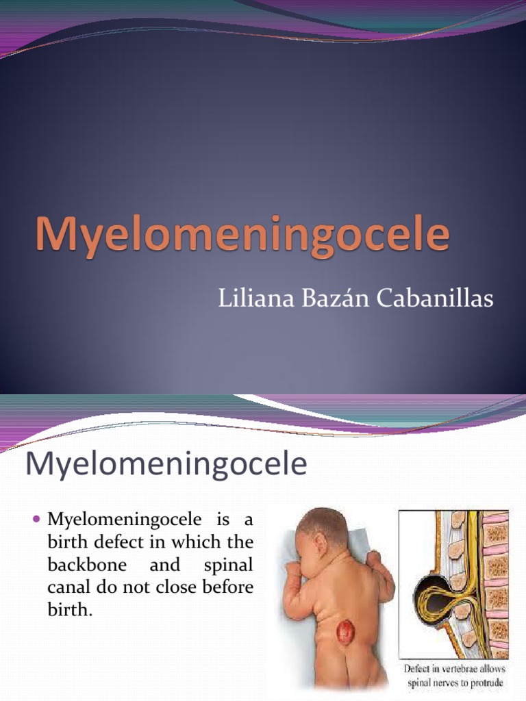 Myelomeningocele | Neurological Disorders | Rtt