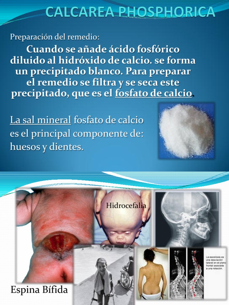 Calcarea Phosphorica | PDF | Hueso | Diente humano