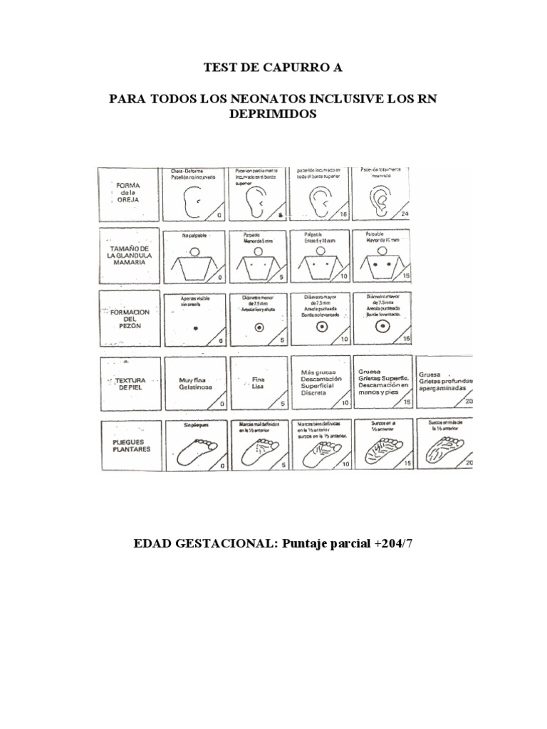 Test de Capurro A y B | PDF