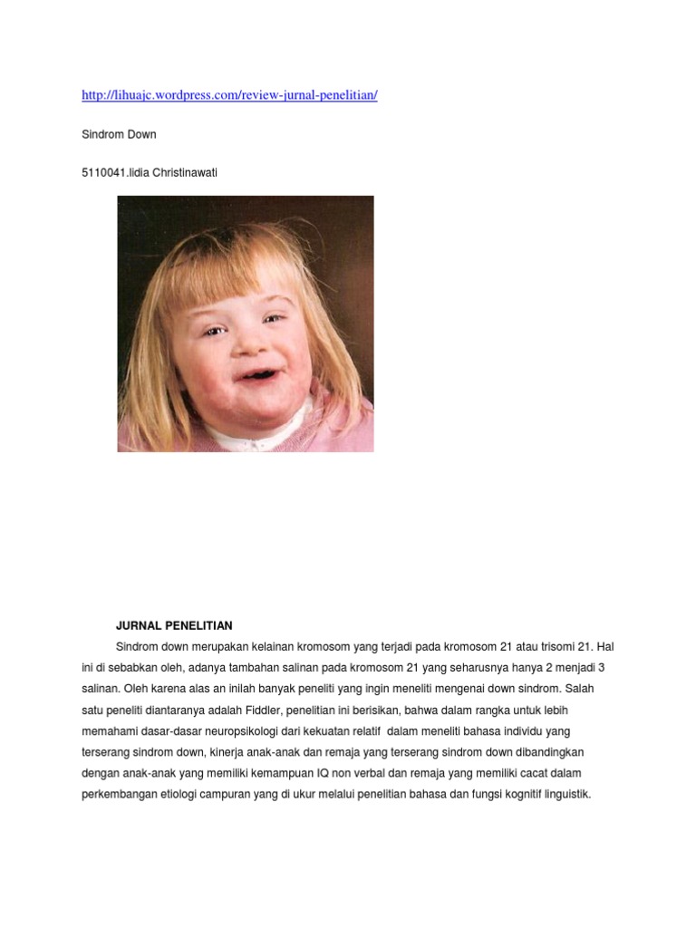 Sindrom Down | PDF