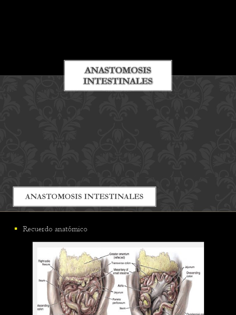 6.- Anastomosis Intestinales | Sutura Quirúrgica | Especialidades Medicas