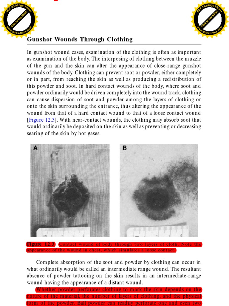 Gunshot Wounds on Clothing - Arma de fogo | Cartridge (Firearms) | Bullet