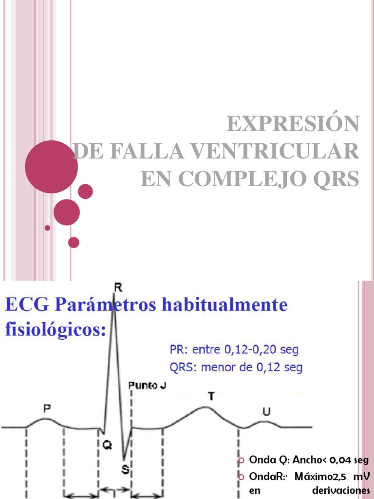 Análisis del Complejo QRS Patológico | PDF | Electrocardiografia ...
