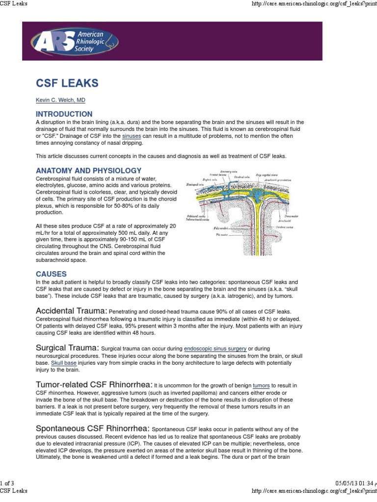 CSF Leaks | PDF | Cerebrospinal Fluid | Ct Scan