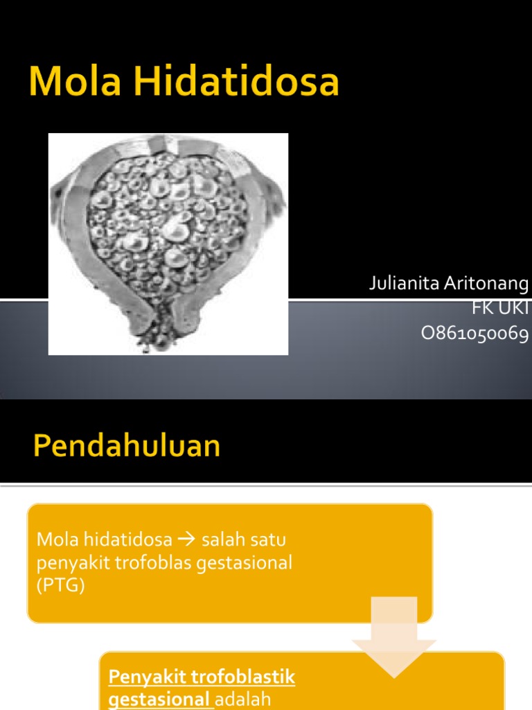 Referat Mola Hidatidosa | PDF