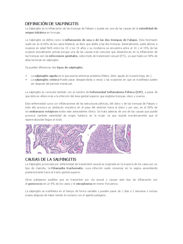 DEFINICIÓN DE SALPINGITIS | Infección transmitida sexualmente | Rtt