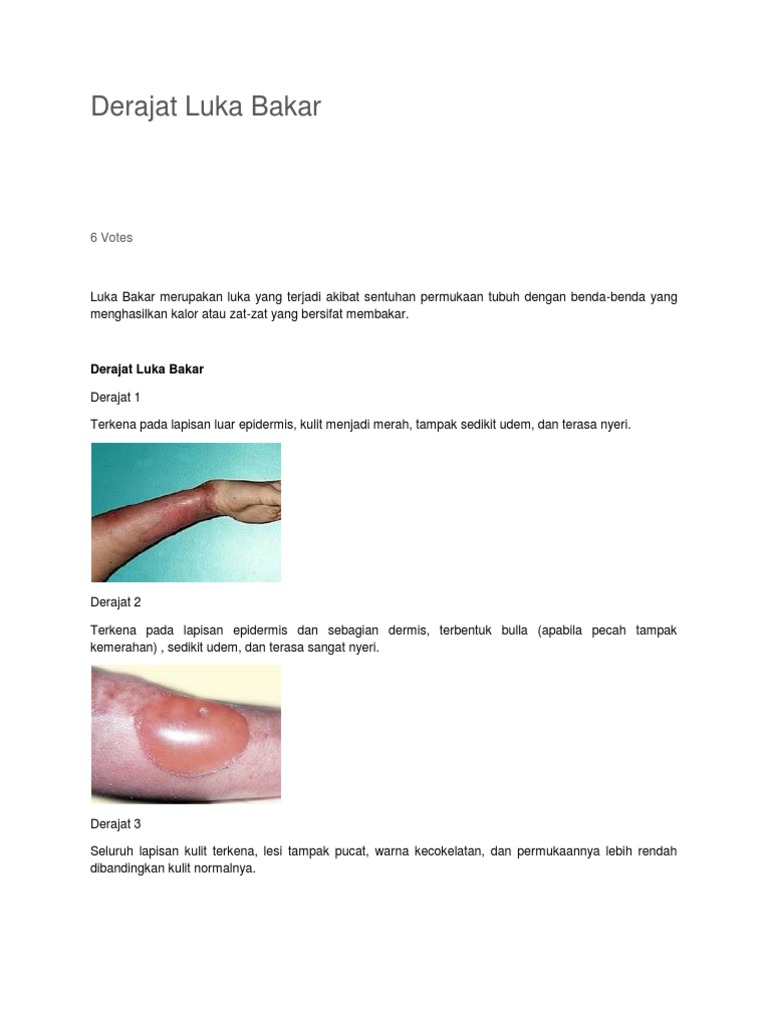 Derajat Luka Bakar | PDF