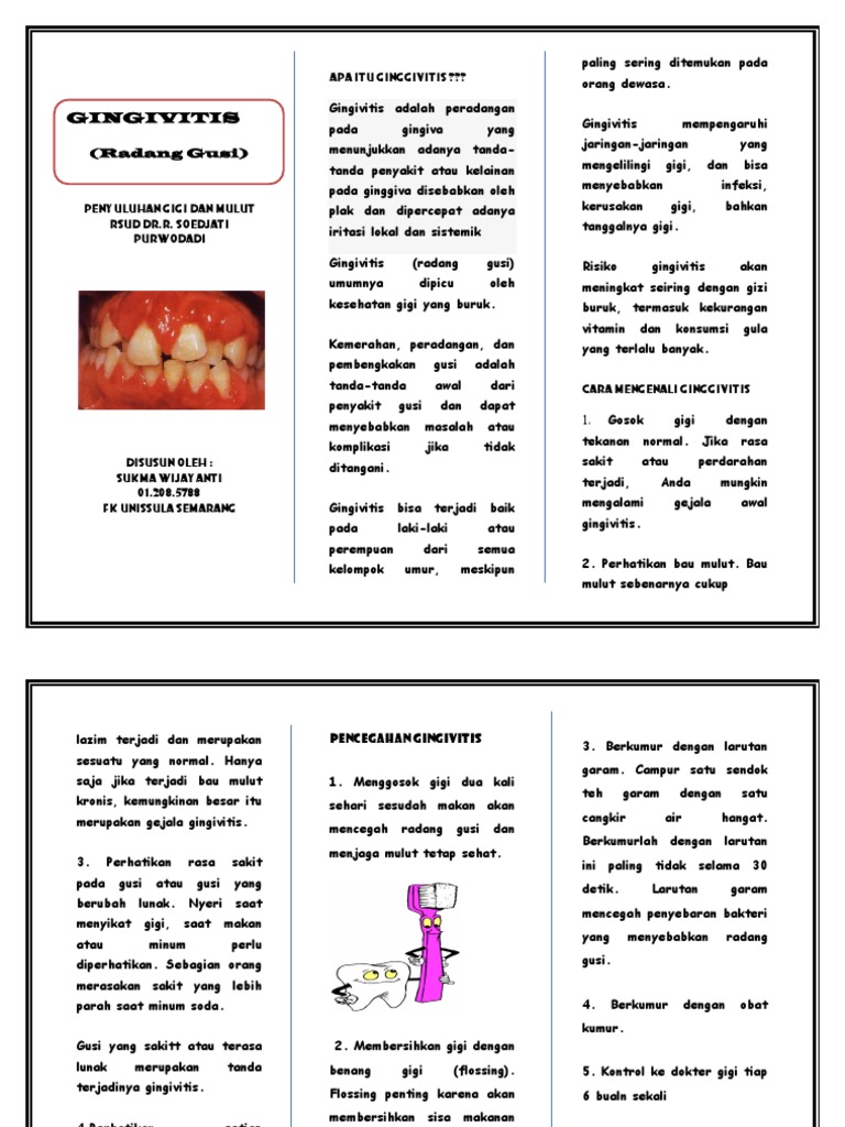 Gingivitis | PDF