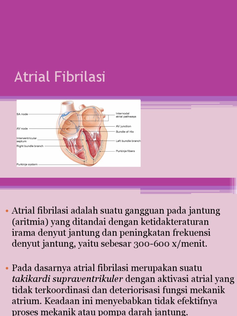 Atrial Fibrilasi | PDF | Sains & Matematika