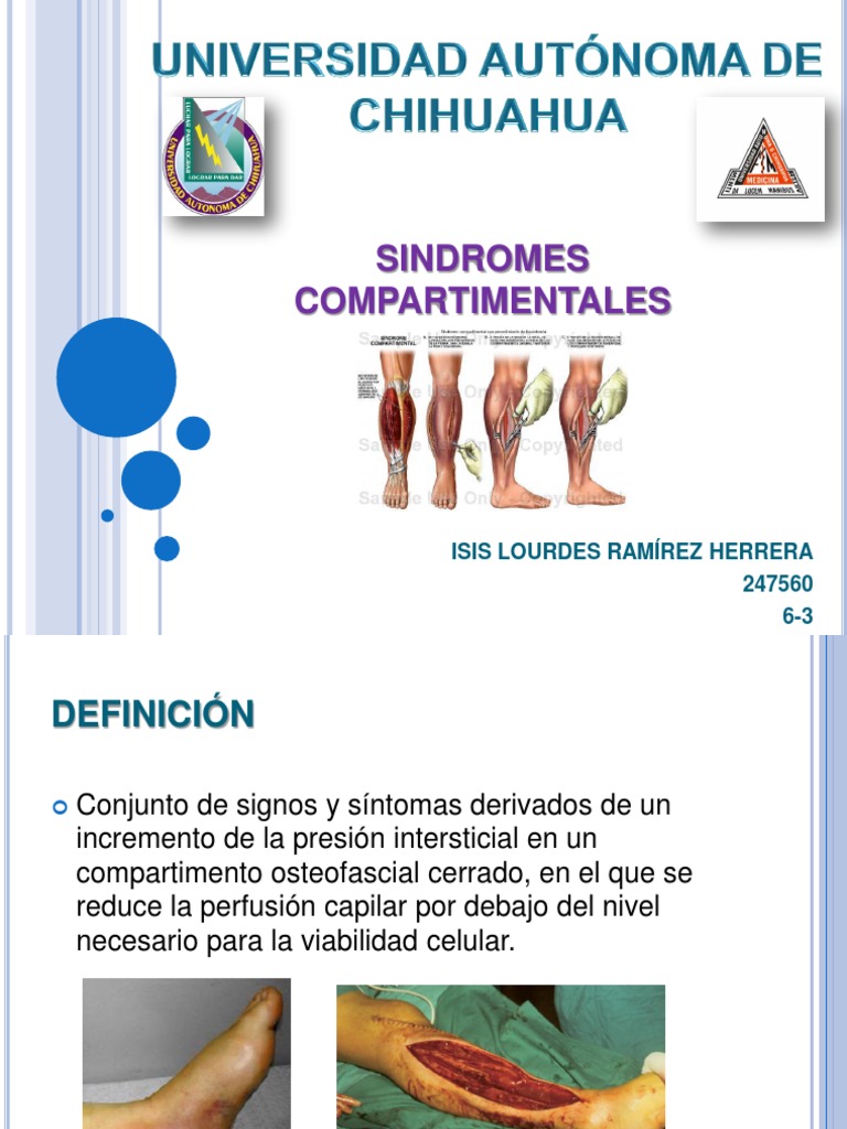 Fisiopatología y Signos del Síndrome Compartimental | PDF | Pie | Mano
