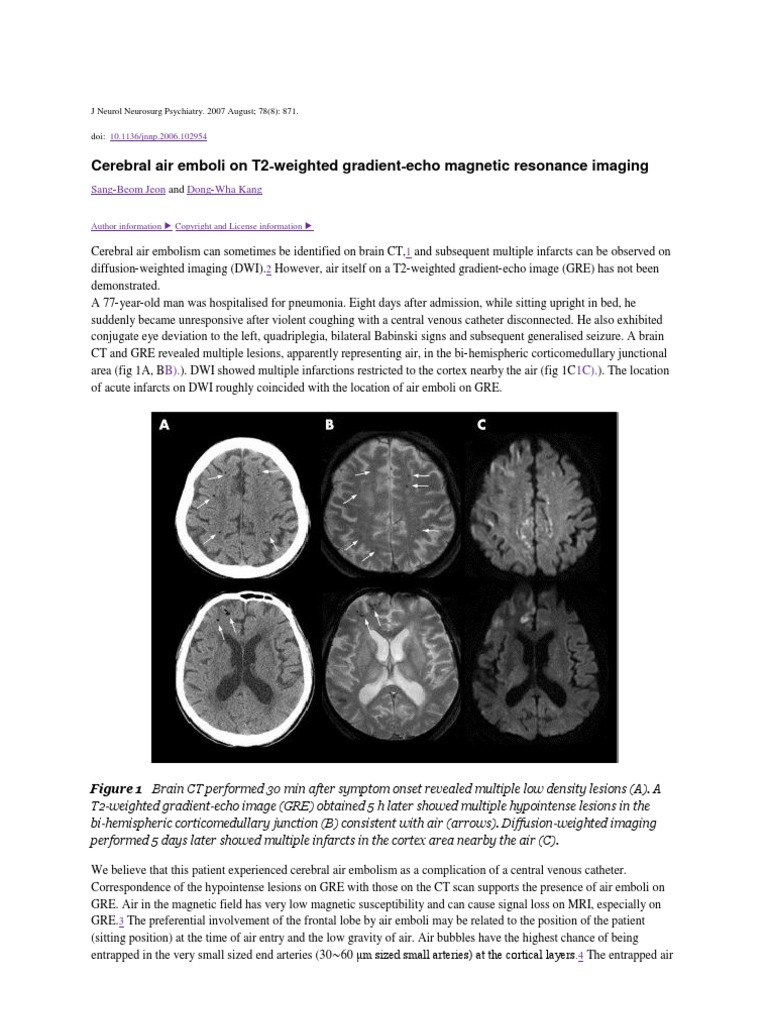 Cerebral Air Emboli On T2 Weighted Gradient Echo Magnetic Resonance ...