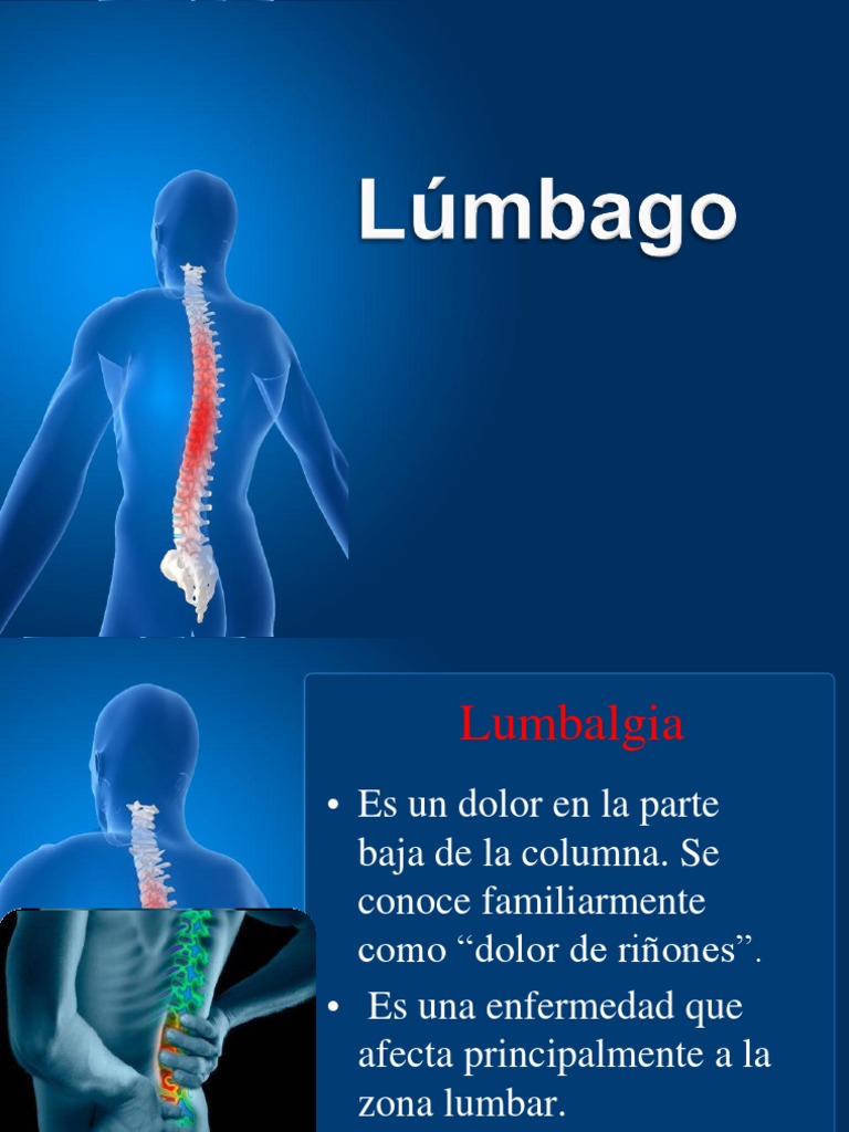 Lumbago | Dolor lumbar | Medicina