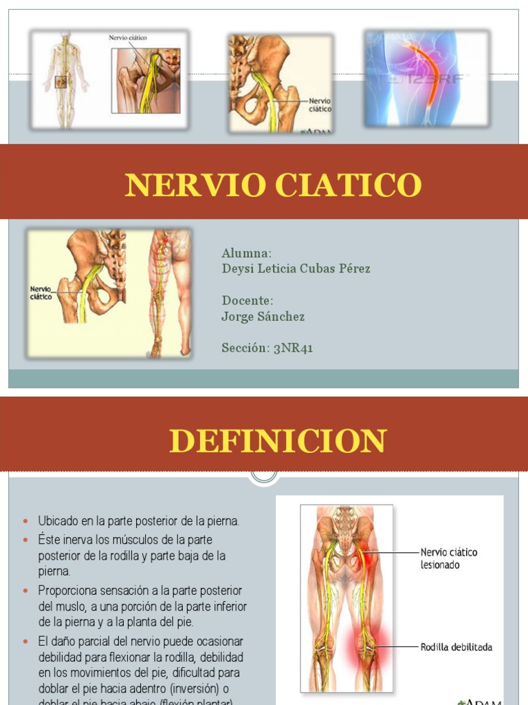 Tratamiento Y Causas Del Dolor Ciático Pdf Medicina Enfermedades