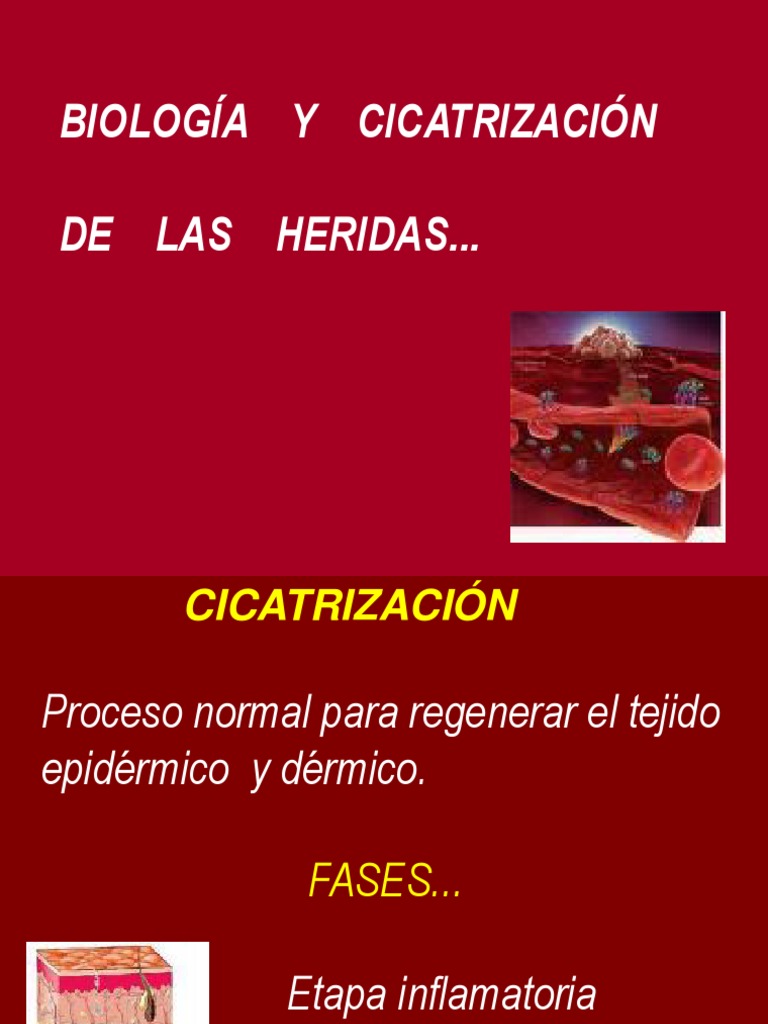 Fases y factores en cicatrización de heridas | PDF | Cicatrización de ...