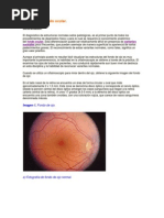 Qué es la espermarquia y su proceso | PDF | Eyaculación | Semen