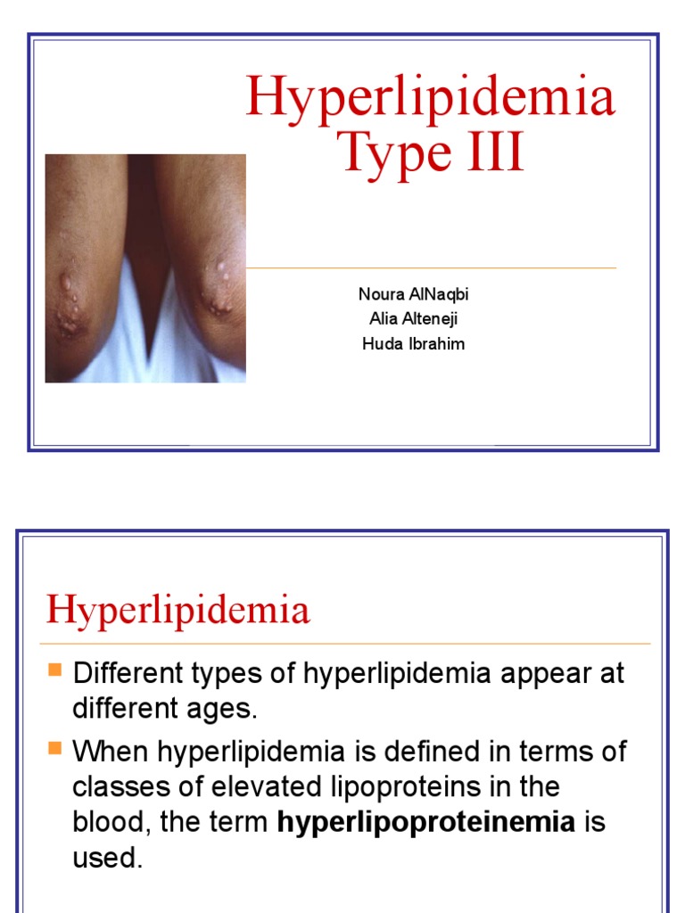 Hyperlipidemia Type | PDF