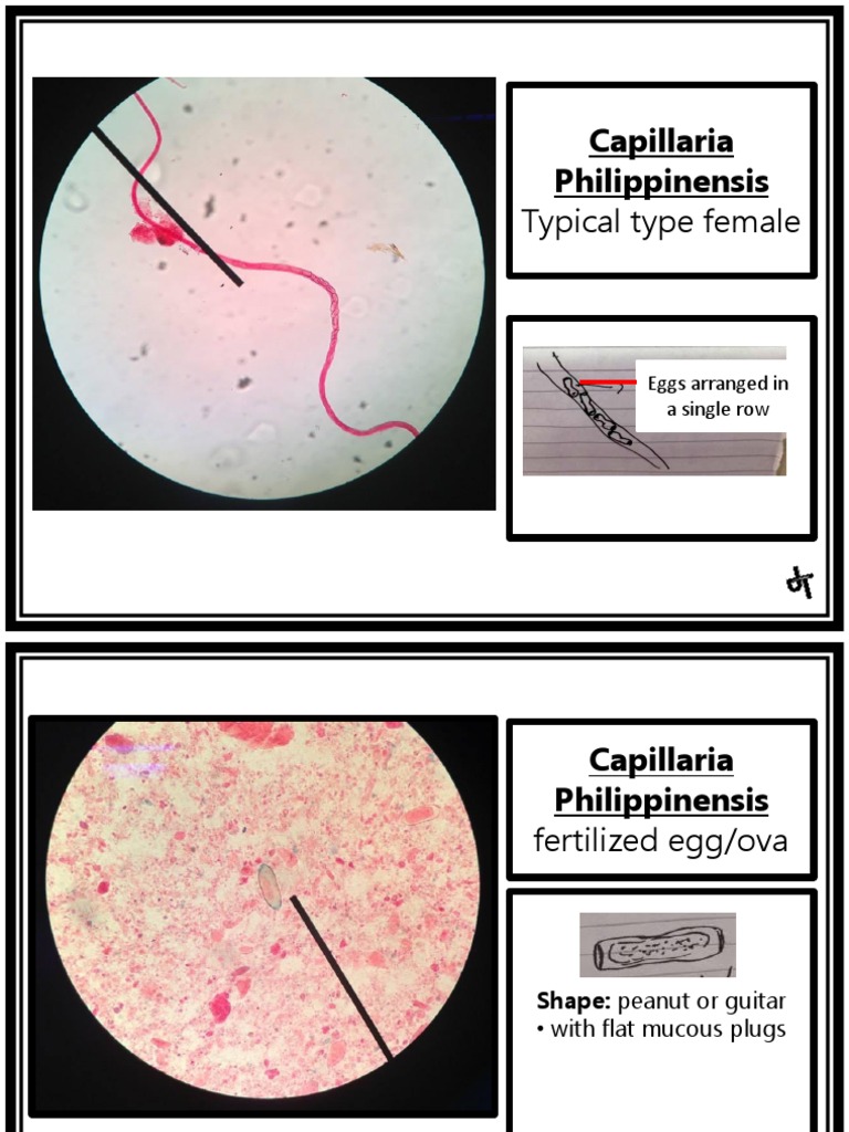 Parasitology (Laboratory) - NEMATODES - Capillaria Philippinensis