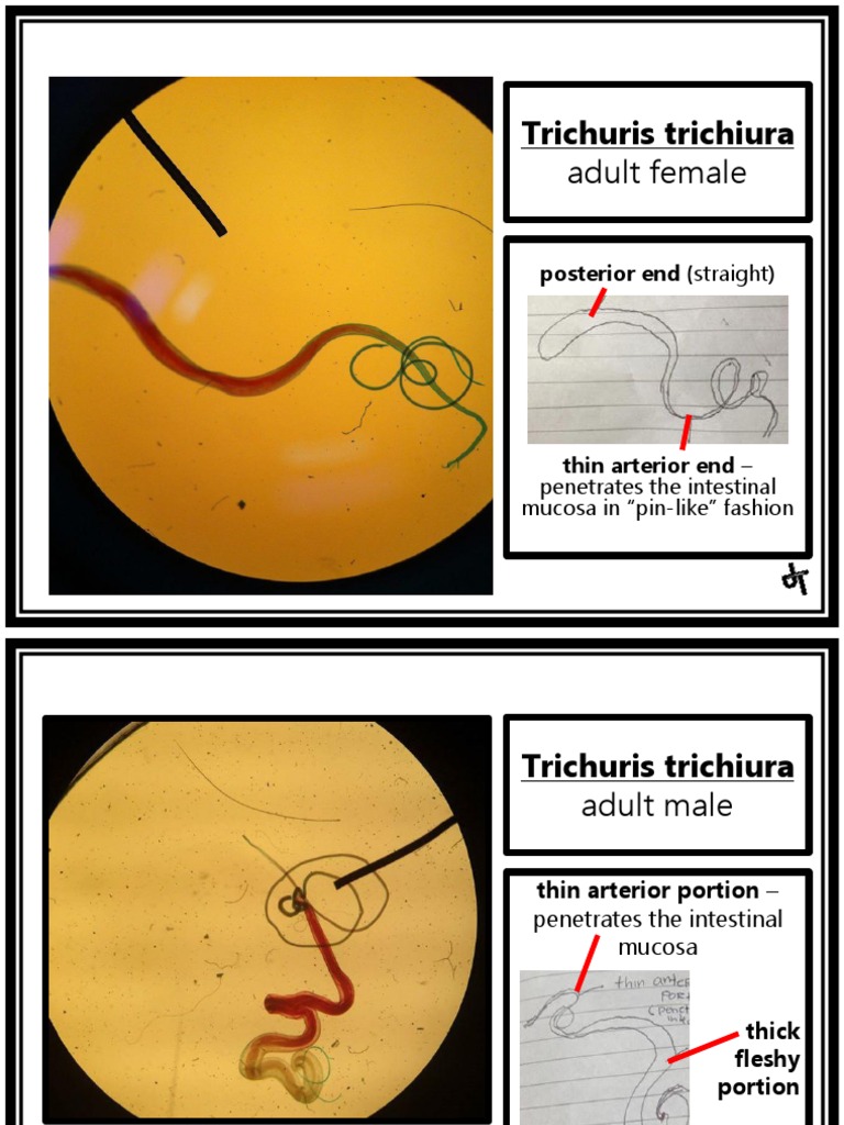 Parasitology (Laboratory) - Trichuris Trichiura | PDF