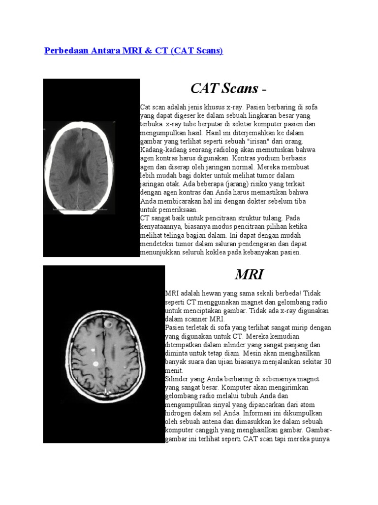Perbedaan CT Scan dan MRI | PDF