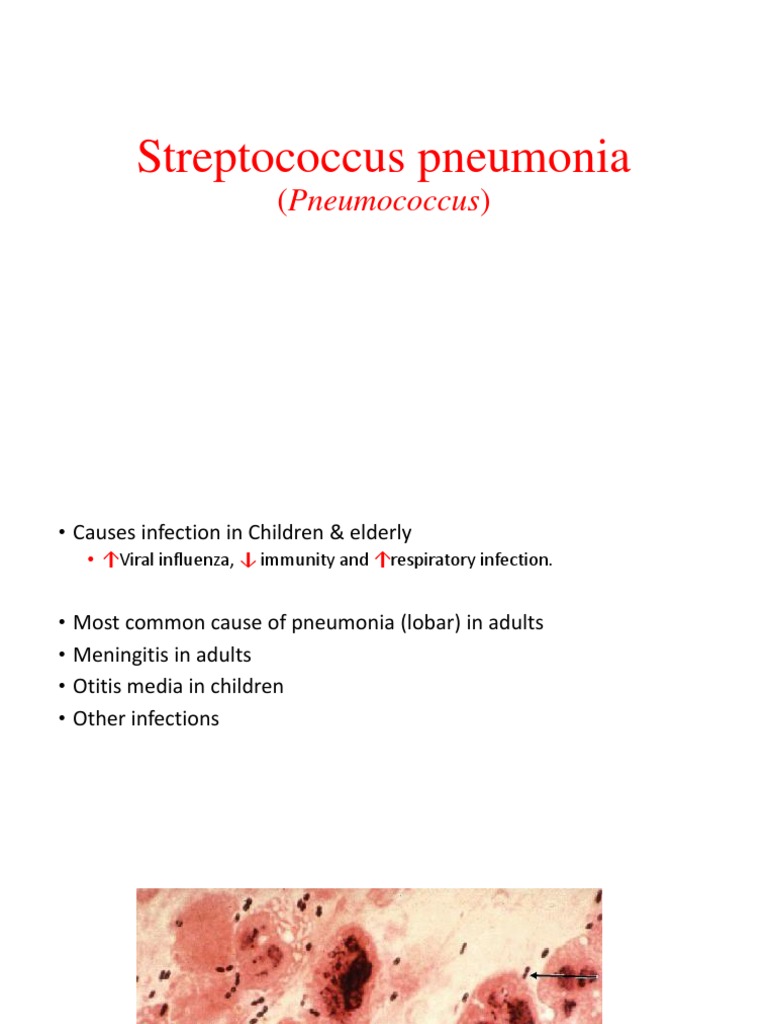 Streptococcus Pneumonia or Pneumococcus | PDF
