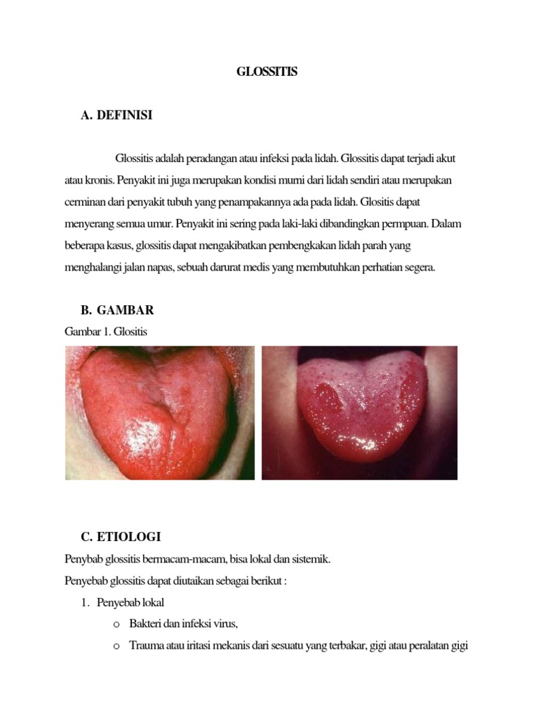 Glossitis | PDF