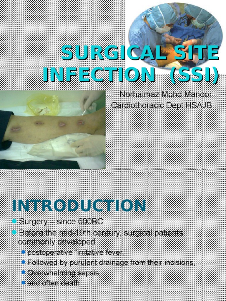 Surgical Site Infections | PDF | Surgery | Infection