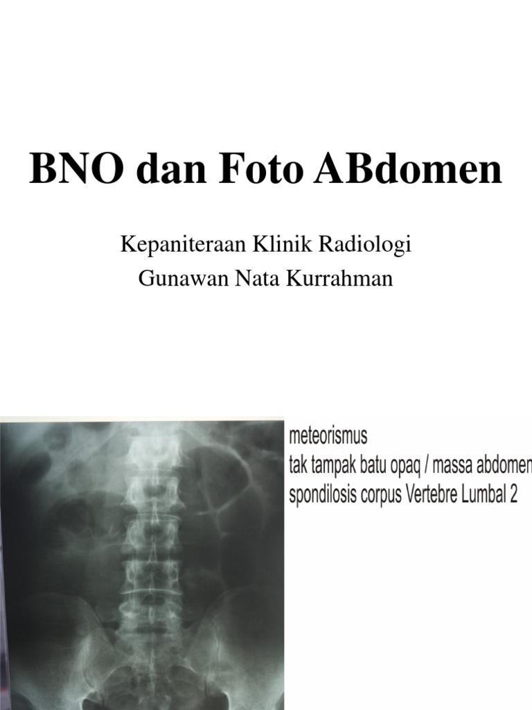 BNO Dan Foto ABdomen | PDF
