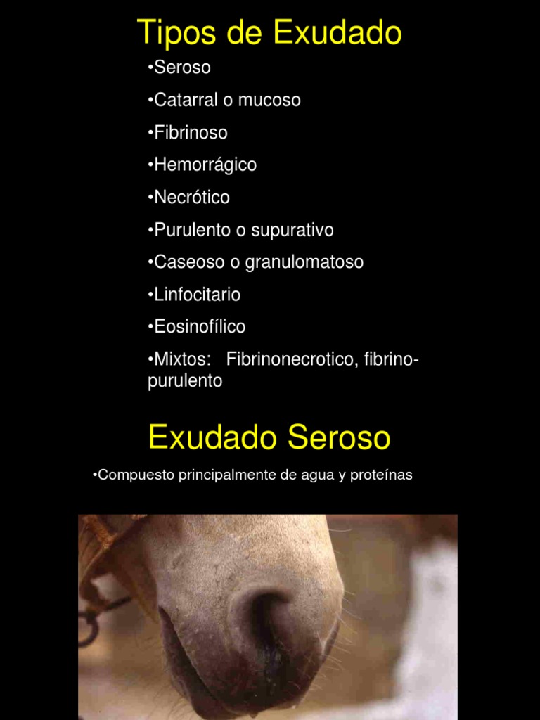 Tipos de Exudado en Procesos Inflamatorios | PDF | Salud y bienestar