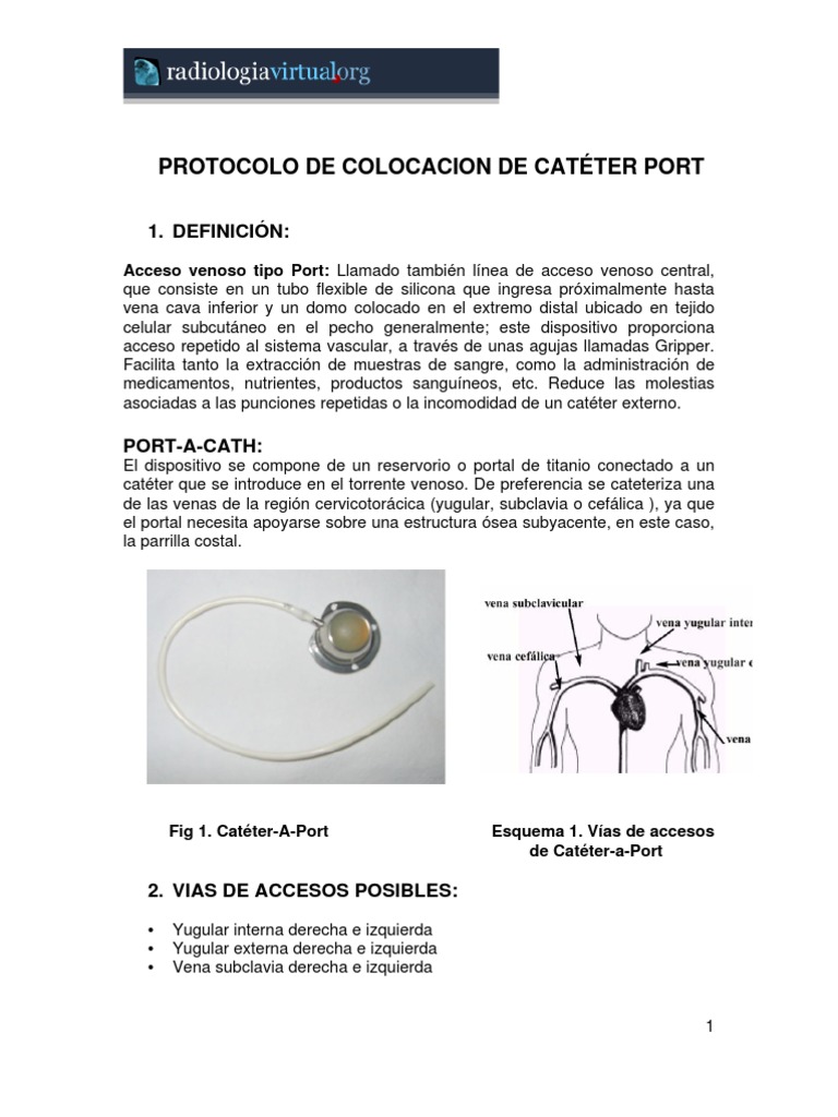 JMQ Cateter Port | PDF | Vena | Ultrasonido médico