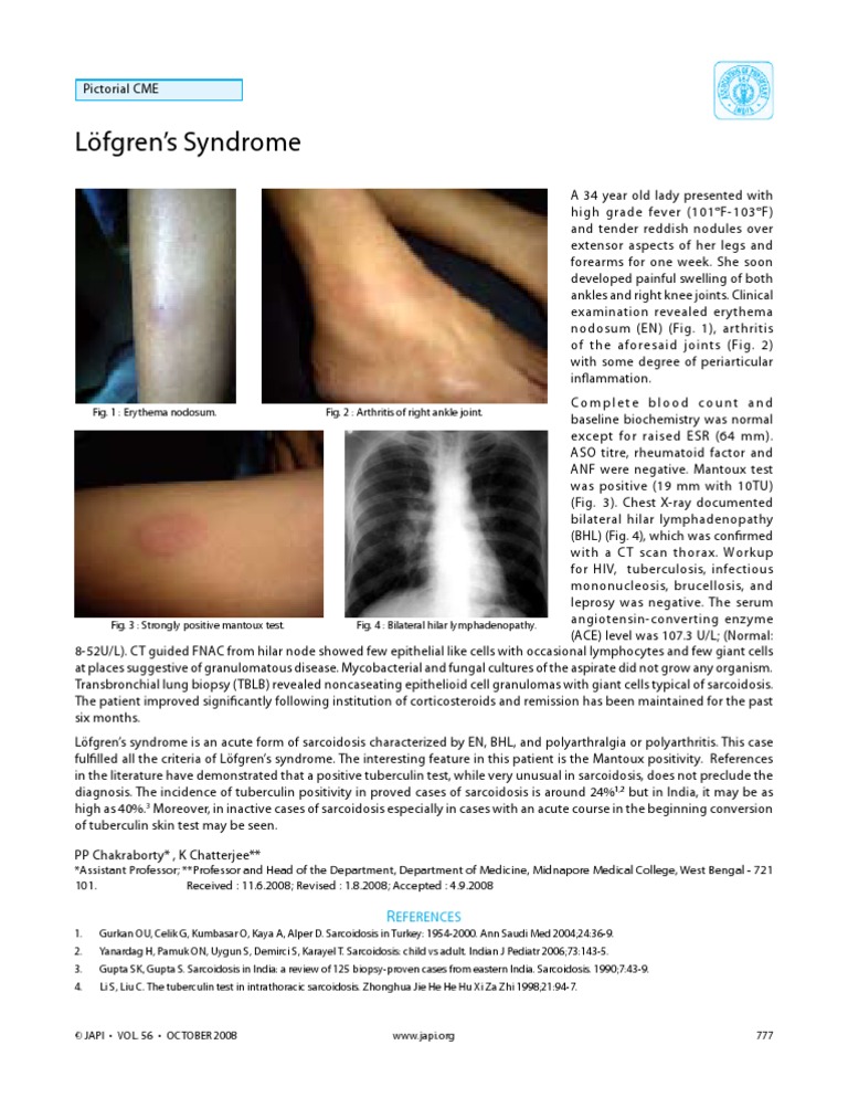 Löfgren’s Syndrome | Medical Specialties | Diseases And Disorders