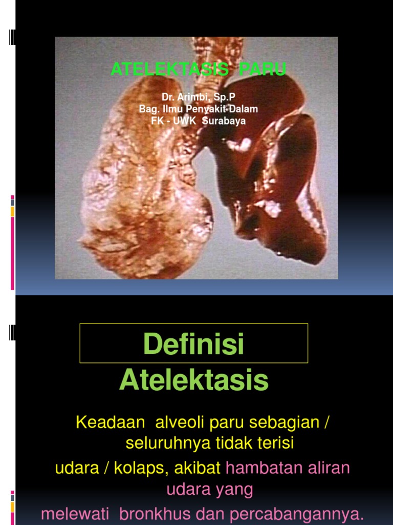 ATELEKTASIS | PDF