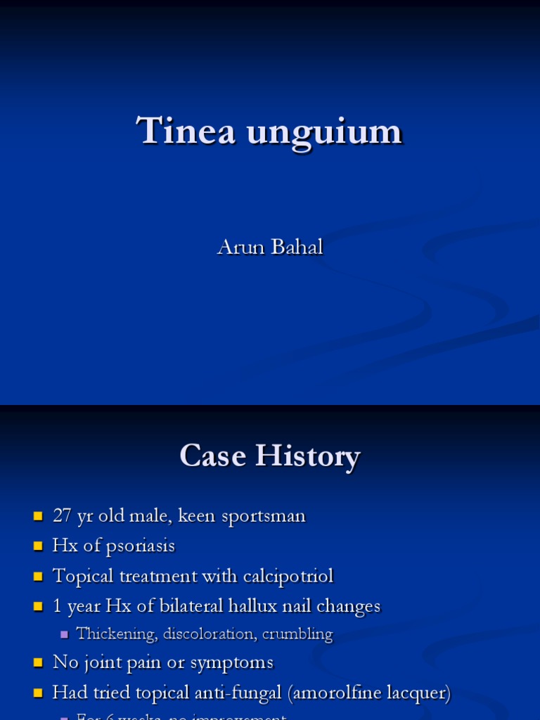 Tinea Unguium | PDF | Diseases And Disorders | Clinical Medicine