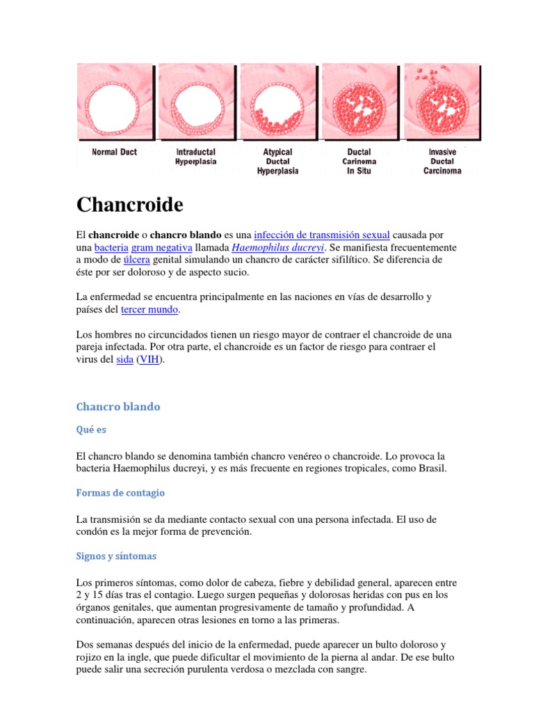 Chancroid e | PDF | Infección transmitida sexualmente | Úlcera péptica