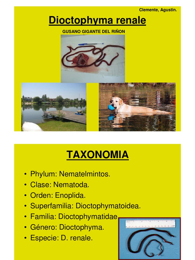 Dioctophyma Renale PDF | PDF | Salud y bienestar