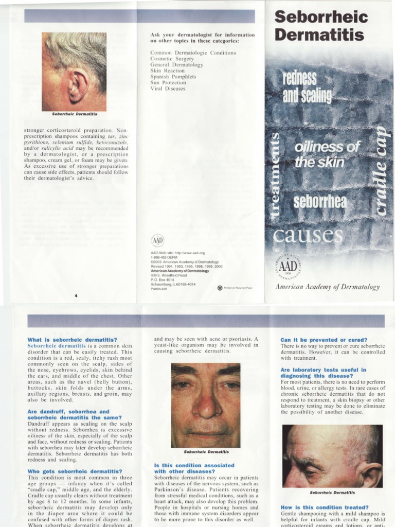 Dermatitis Download Free Pdf Dermatitis Dermatology