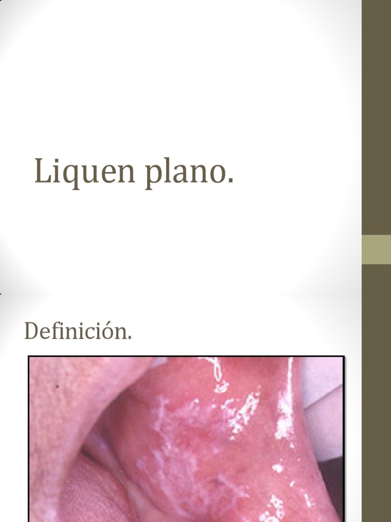 Liquen Plano | Descargar gratis PDF | Sistema inmune | Inmunología