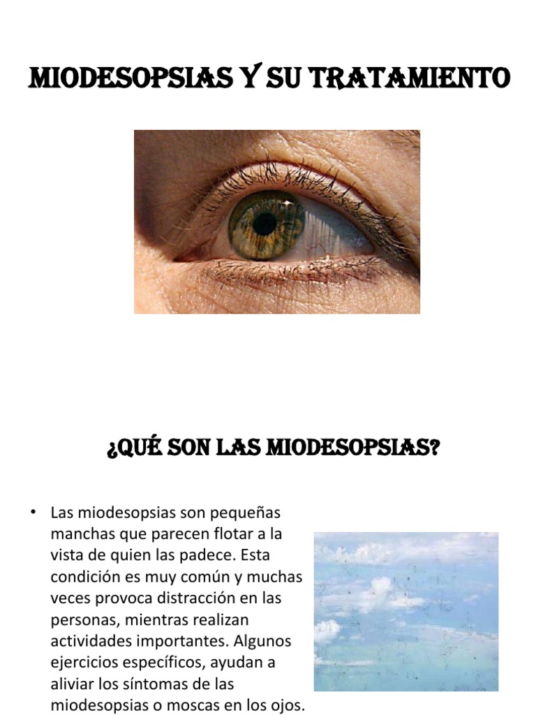 Miodesopsias Tratamiento: Cual Es El Mejor Tratamiento para Las ...