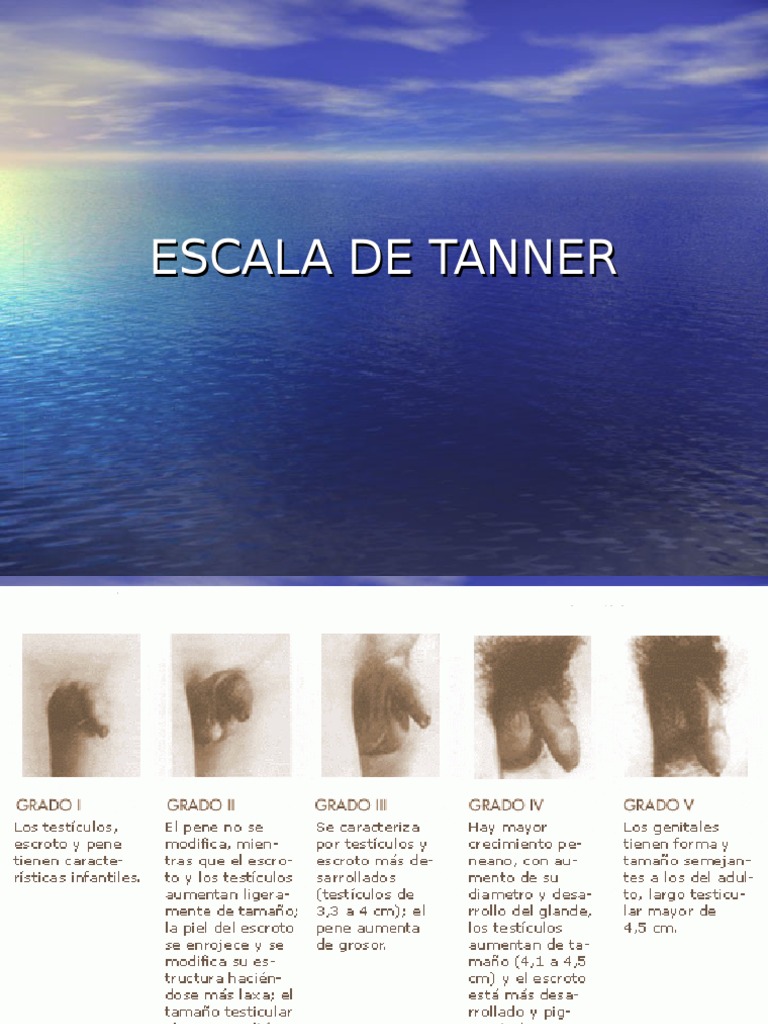 7. Escala de Tanner