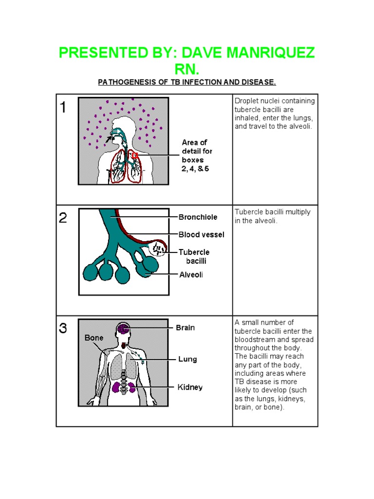 Pathogenesis of TB Infection and Disease | PDF | Wellness