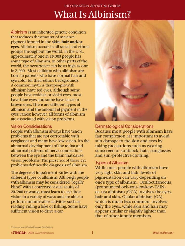 What Is Albinism | PDF | Visual Impairment | Eye Color